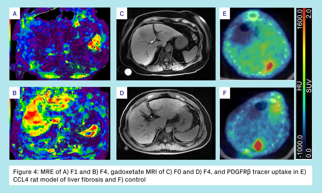 What is an imaging biomarker? An important tool in drug development ...